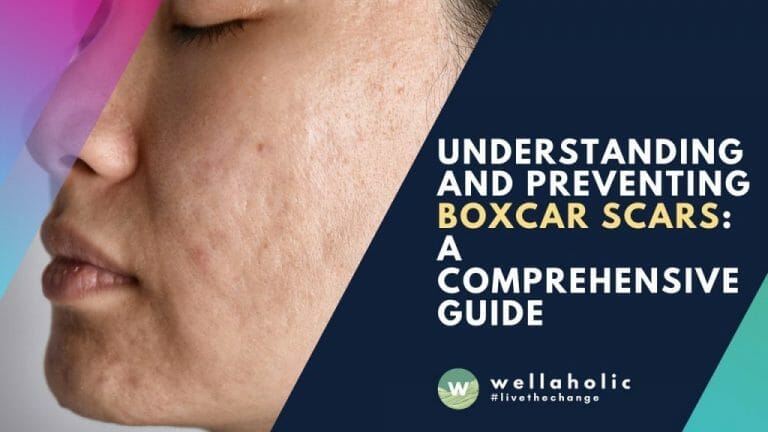 The Ultimate Guide to Banishing Boxcar Scars Forever