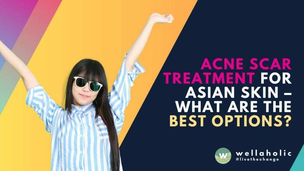 Acne Scar Treatment for Asian Skin - What Are the Best