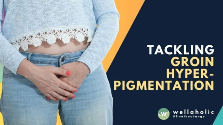 The Ultimate Cheat Sheet for Tackling Groin