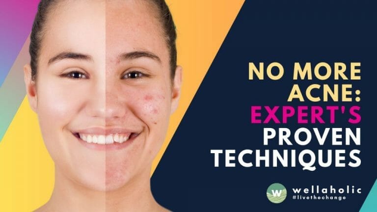 Shiok! Your Ultimate Guide to Banishing Acne Scars